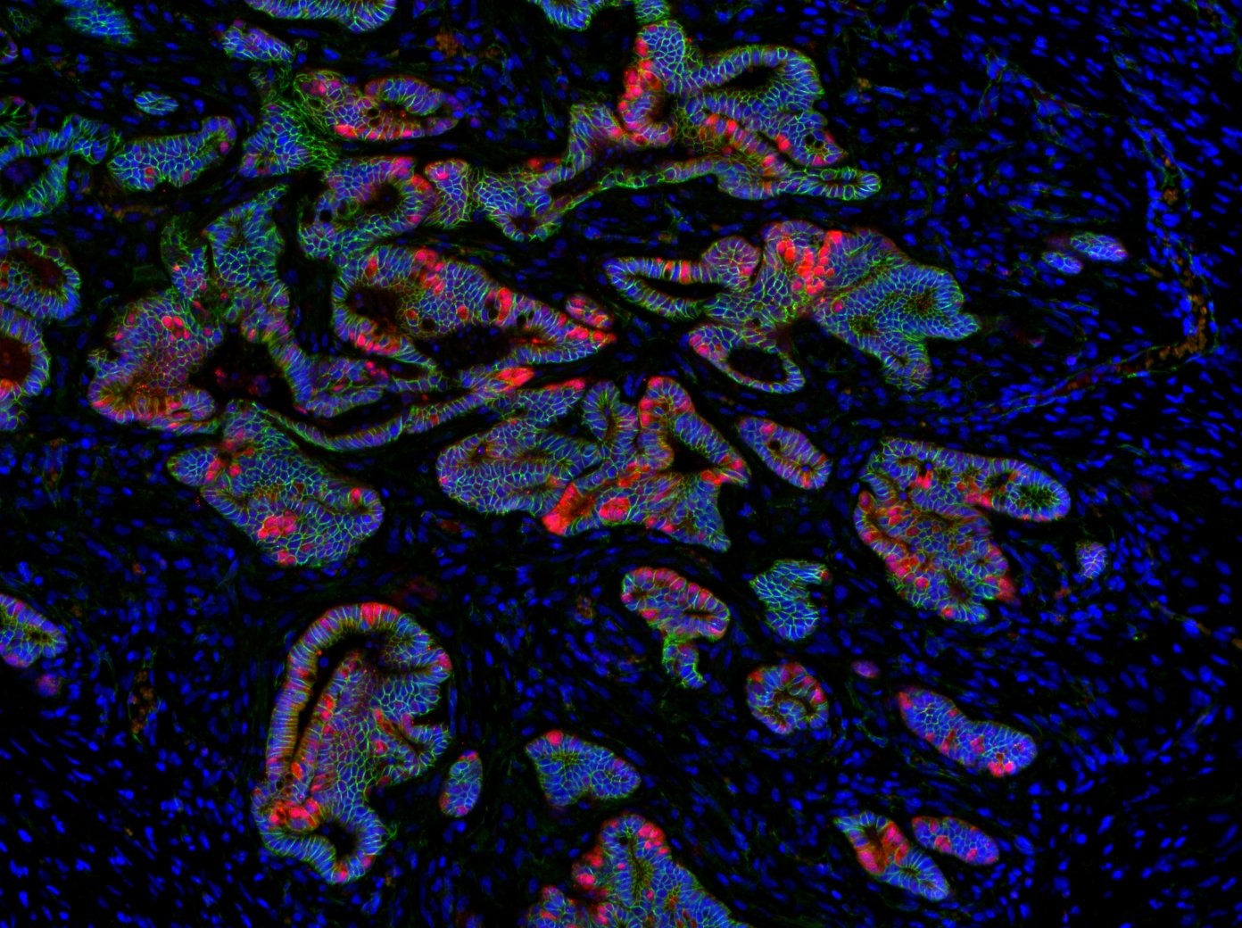 Imagen de una inmunofluorescencia donde se aprecian células con ...